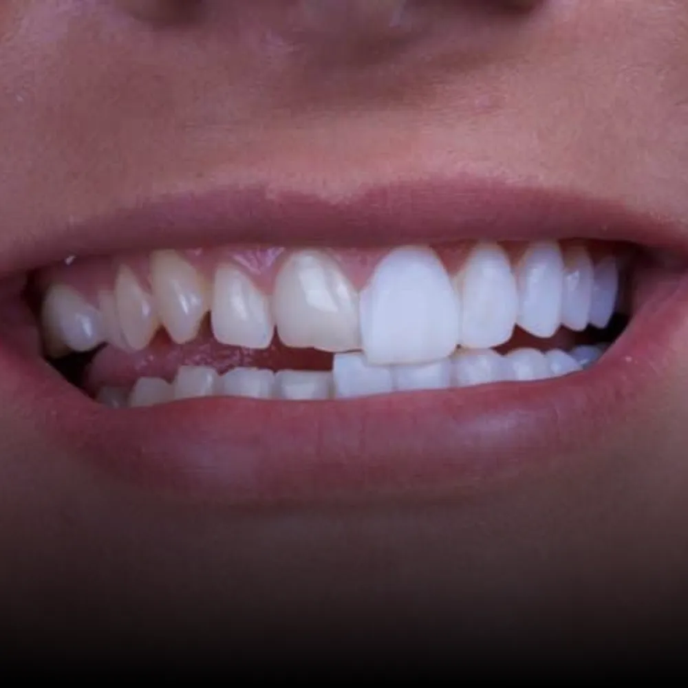 Spire Dental – Dental Clinic